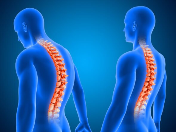 10 Lower And Middle Trap Exercises For Enhanced Posture And Strength ...