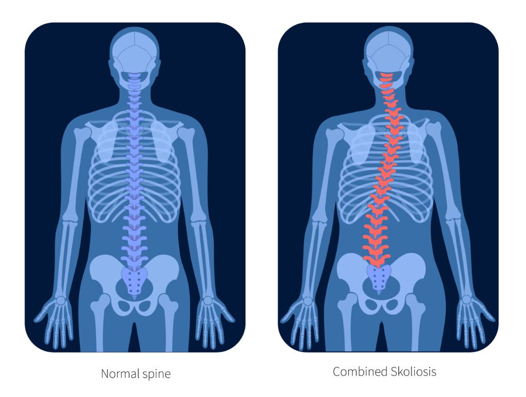 6 Effective Ab Exercises With Plates For A Stronger Core - Workout Guru